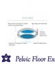 Queen's Square Bladder Stimulator